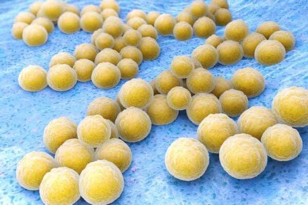 MRSA superbug infections rising in kids with eczema - myDr.com.au